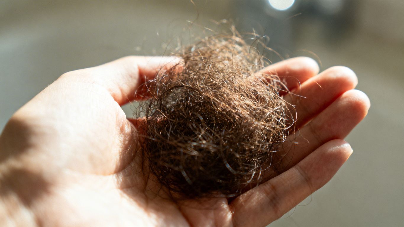 Understanding Hair Falling Out in Clumps: Causes, Concerns, and Soluti ...